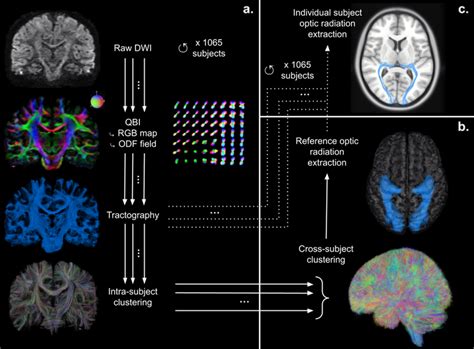 Overview Of The Complete Dmri Analysis Pipeline A Individual Dmri