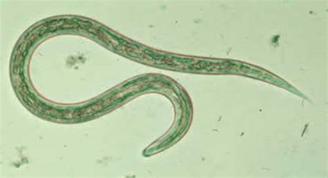 Human Hookworm Infection Can Cause Rapid Acute Cognitive Impairments