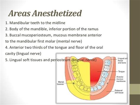 Inferior Alveolar Nerve Block Local Anesthesia Technique