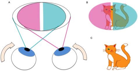 Retinal Hemifield Slide Phenomenon Eyewiki