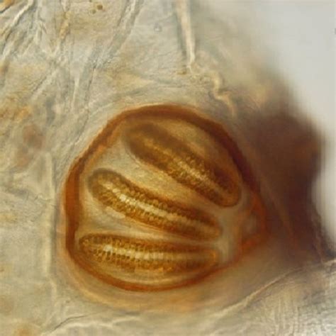 The Anterior End Of The Larva And Terminal Oral Hooks × 40 Download