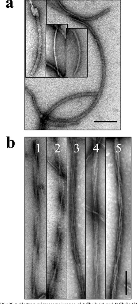 Figure 4 From The Same Primary Structure Of The Prion Protein Yields