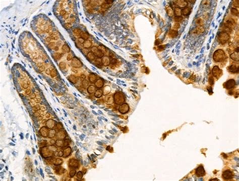 Invitrogen Acss2 Polyclonal Antibody 100 μl Buy Online Invitrogen
