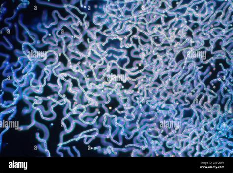 Light Micrograph Of Nostoc Sp A Blue Green Nitrogen Fixing Algae