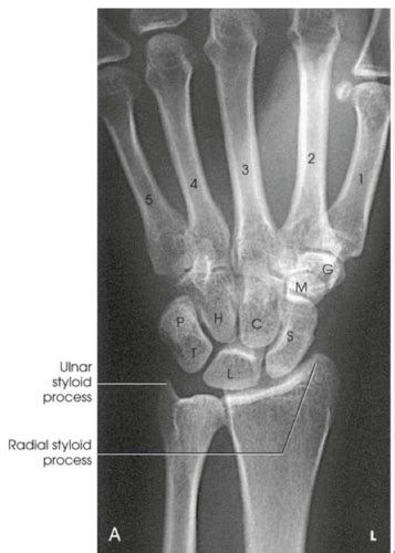 Hb101 Palpations Flashcards Quizlet