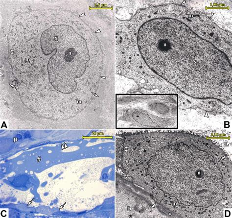 A Em Of A Decidual Rounded Evt N Nucleus N Nucleolus Arrowhead