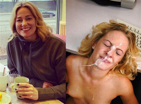 Before After Facials F1 9 Porn Pic Eporner Before After Facials F1 9 Porn Pic Eporner