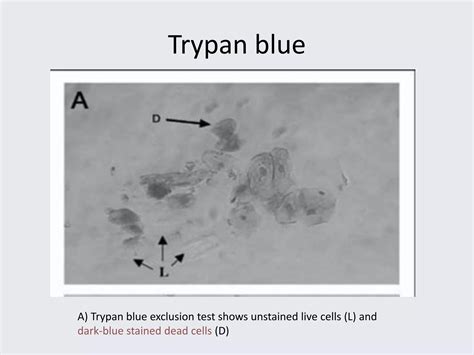 Vital Staining Ppt Notes Pptx
