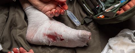 External Bleeding First Aid New Arrivals For Bleeding