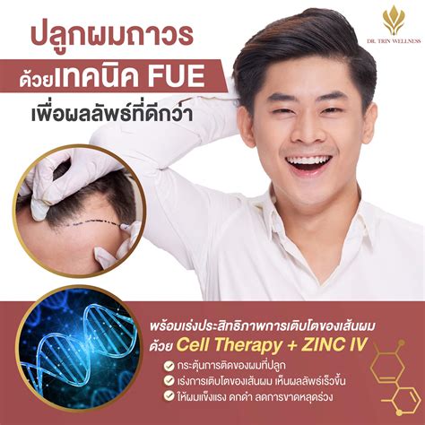 ปลูกผมถาวร Fue Cell Therapy ไร้รอยแผล ไม่ต้องผ่าตัด ผมหนา ดกดำ มั่นใจ