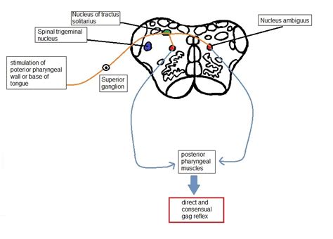 Physiology Gag Reflex Treatment And Management Point Of Care