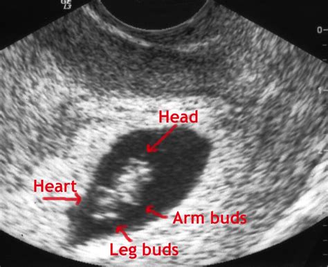 7 Weeks Pregnant Preg Med