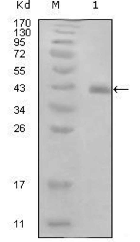 Hpv Type 16 E7 Monoclonal Antibody 3d6f1 Invitrogen™ 100 μl