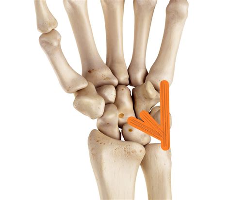 Tfcc Tears Of Your Wrist Hand And Wrist Injuries Pint