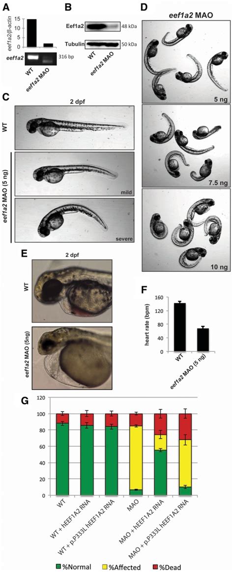 Homozygous Eef1a2 Mutation Causes Dilated Cardiomyopathy Failure To