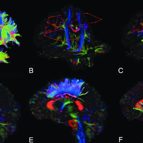 Dti Based Tractography Post Processing With Exploredti A Download Scientific Diagram