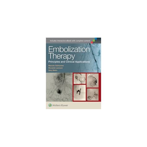 Embolization Therapy Principles And Clinical Applications Lencioni