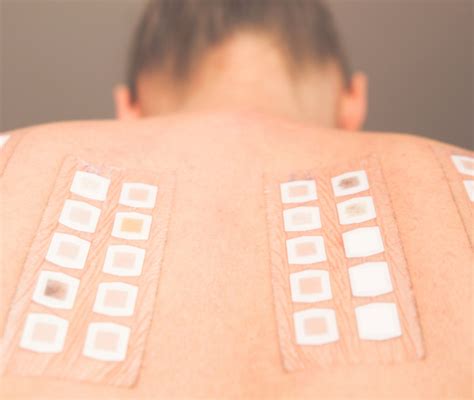 Can I Shower With Patch Test At Walter Paul Blog