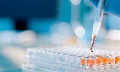 The Mercodia Glucagon Elisa Laboratory Talk