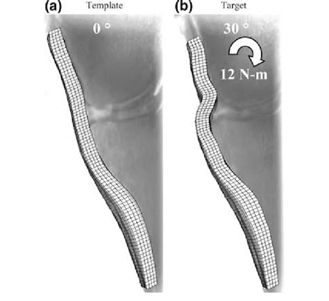 Hyperelastic Warping Solution For Knee 1 Showing Side View Of The