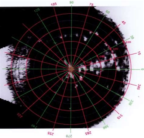 A Polar Grid Transparency Was Placed Over The Monitor Displaying The