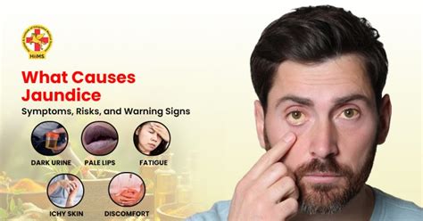 What Causes Jaundice Signs Reasons And Treatment What Causes Jaundice Signs Reasons And Treatment