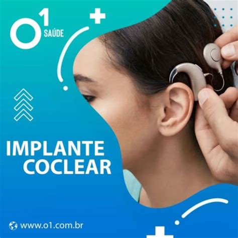 Você Já Ouviu Falar Em Implante Coclear O1 Saúde