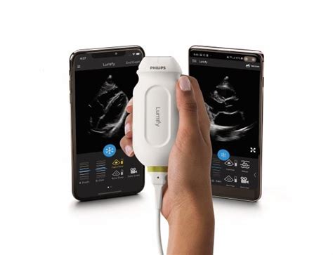 Philips Lumify Handheld S4 1 Phased Array Ultrasound