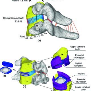 Developed Three Dimensional Finite Element FE Models A FE Model Of