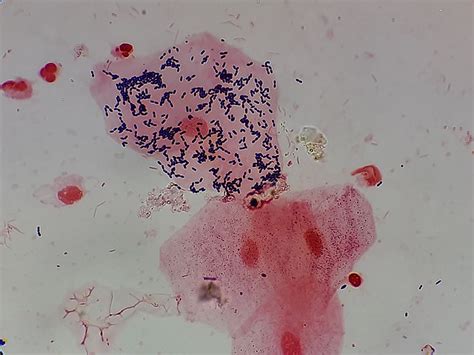 The Gram Stain Tutorial Microbiology Learning The Whyology Of