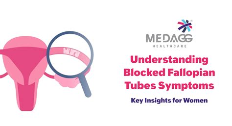How To Shrink Thyroid Nodules Without Surgery A Comprehensive Guide Medagg