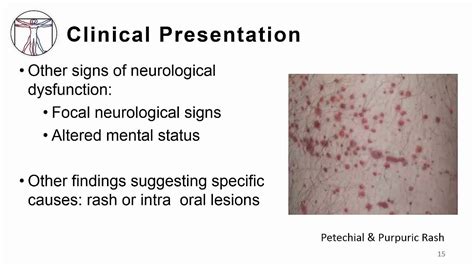 1 Overview Meningitis And Encephalitis Youtube