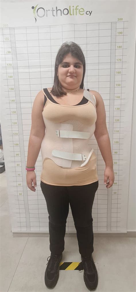 Eleftherios Samiotis On Linkedin 👌 Rigo Cheneau 3d Printed 👍 Nice