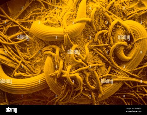 False Colour Scanning Electron Micrograph Of The Predatory