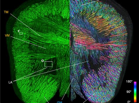 Machine Vision Laser Piv Laser Photothermal Photodynamic Laser
