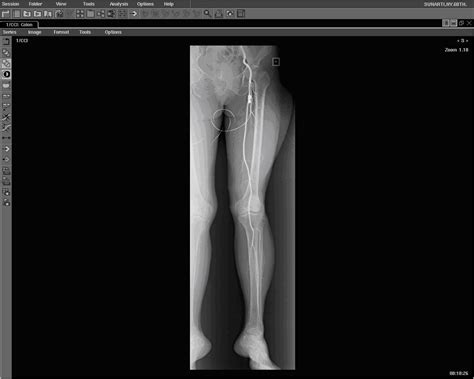 Radiologi Digital Radiography Dr