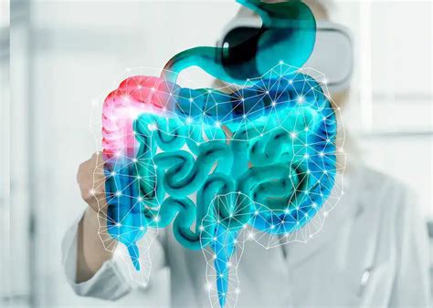 ¿qué Es La Colitis Dra Nadia Chahri