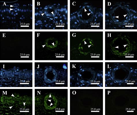 Detection Of In Situ Dna Fragmentation By Dapi And Tunel Assay Ad