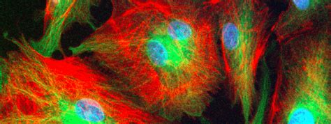 Protein Colocalization You Know They Overlap But Can You Prove It