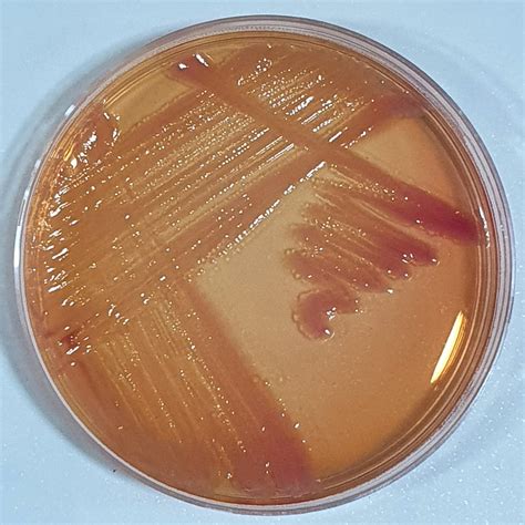 ‫🔹️enterobacter Cloacae Complex On علم التحليلات المرضية Facebook‬