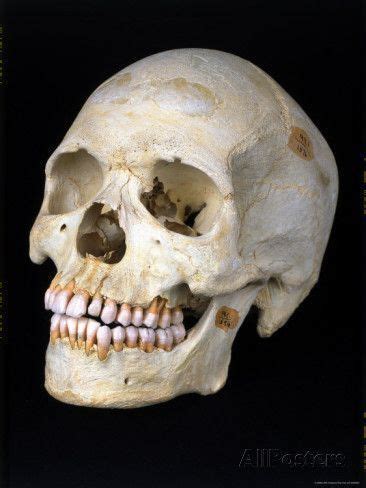 0 Photographic Print 0 0 Skull Anatomy Skull