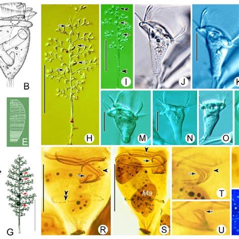 Morphology Of Zoothamnium Alternans In Vivo A D H Q After Protargol