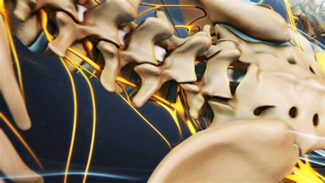 Microdiscectomy Microdecompression Spine Surgery