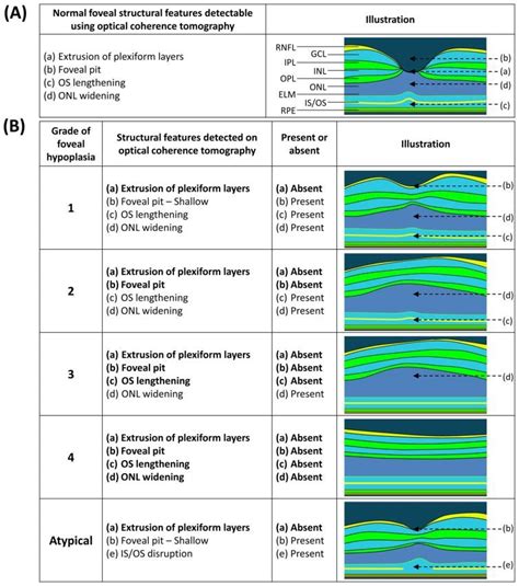 Structural Grading Of Ophthalmology Notes And Synopses Facebook