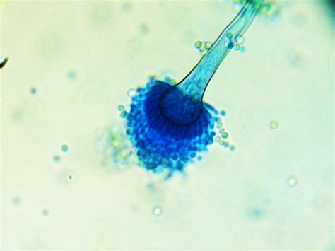 Lactophenol Cotton Blue Stain Flickr