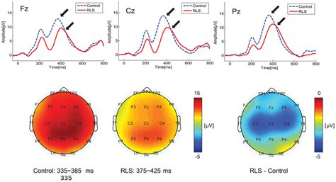 Event Related Potential Erp Waveforms And Topography Of The P300