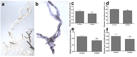 Morphological Characteristics Of Prothoracic Gland Of 5 Th Instar