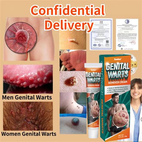 Genital Warts Remover Cream Original 20g Genital Herpes Condyloma Skin