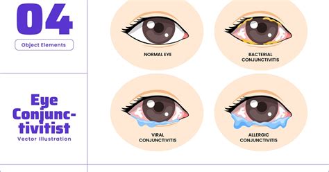 Eye Conjunctivitis Disease From Virus And Bacteria Objects Ft Eye
