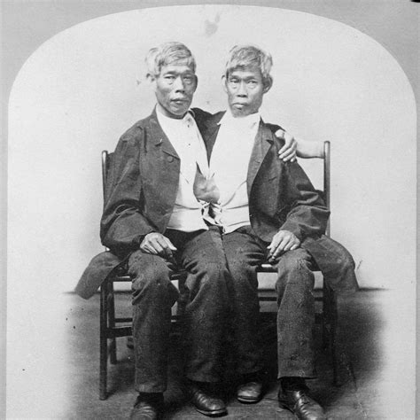 La Extraña Vida De Los Siameses Bunker El Misterio Sobre La Sexualidad Y Sus Cuerpos Conectados